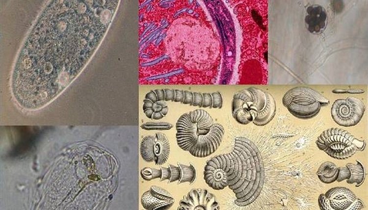 How Do Protists Reproduce Sciencing 
