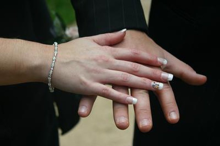 Causes of Hands Swelling | LEAFtv Causes of Hands Swelling | LEAFtv