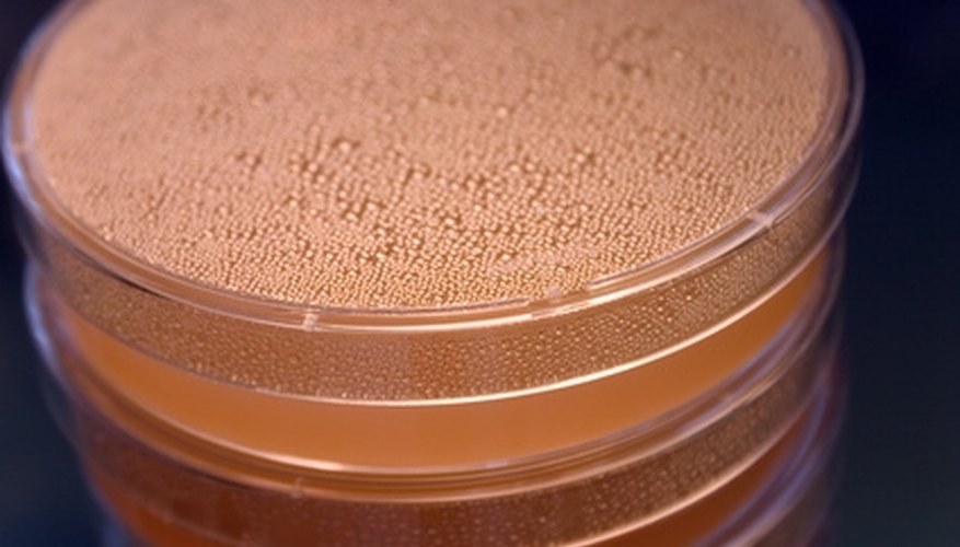 How To Make Agar Plates Sciencing