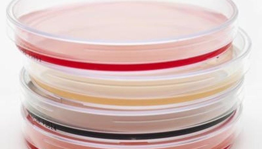 How To Make Your Own Agar For Petri Dishes Sciencing