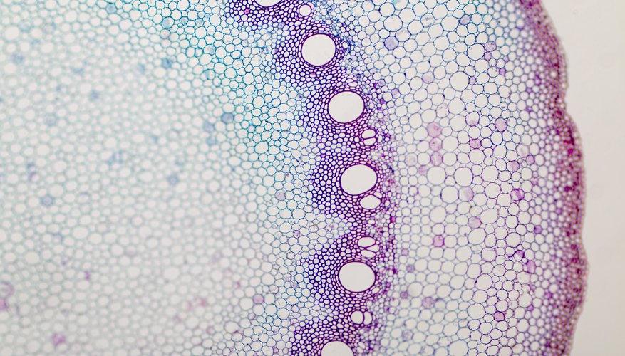How To Calculate Magnification On A Light Microscope Sciencing