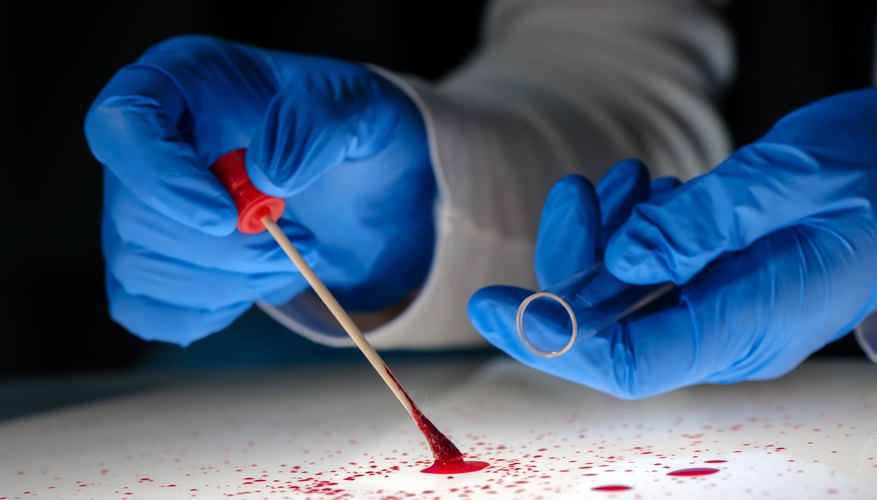 What Are Some Advantages And Disadvantages Of Using DNA Analysis To Aid 